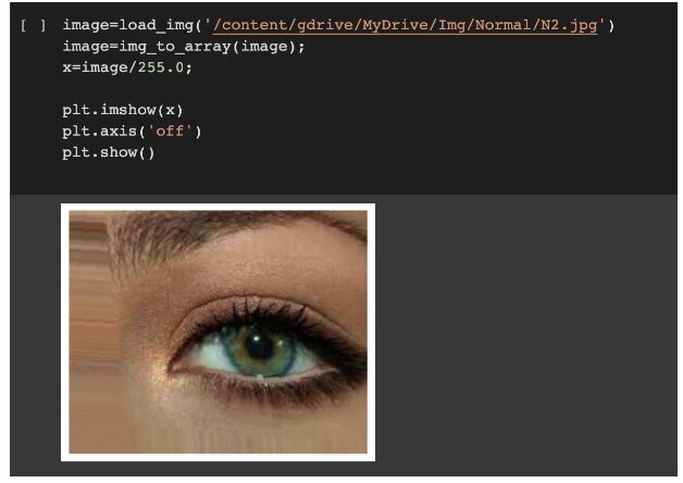 Implementing VGG-16 using Pre-Trained Model - Shiksha Online